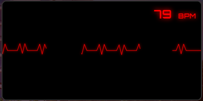 [FREE] tech death screen Custom Death Screen System QBCore - FiveM Releases - Cfx.re Community